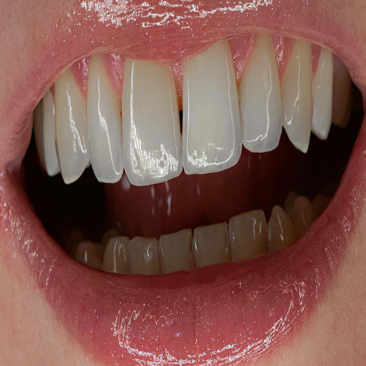 Valerie Ace - Glitzer Vs Hass [SKIN005] – Second Floor Stuff